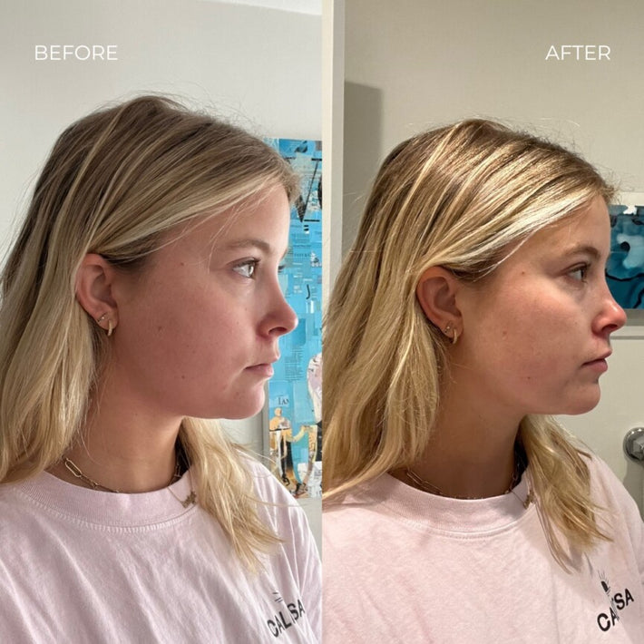 ByHer V-Line Lift Bands – ByHer Beauty